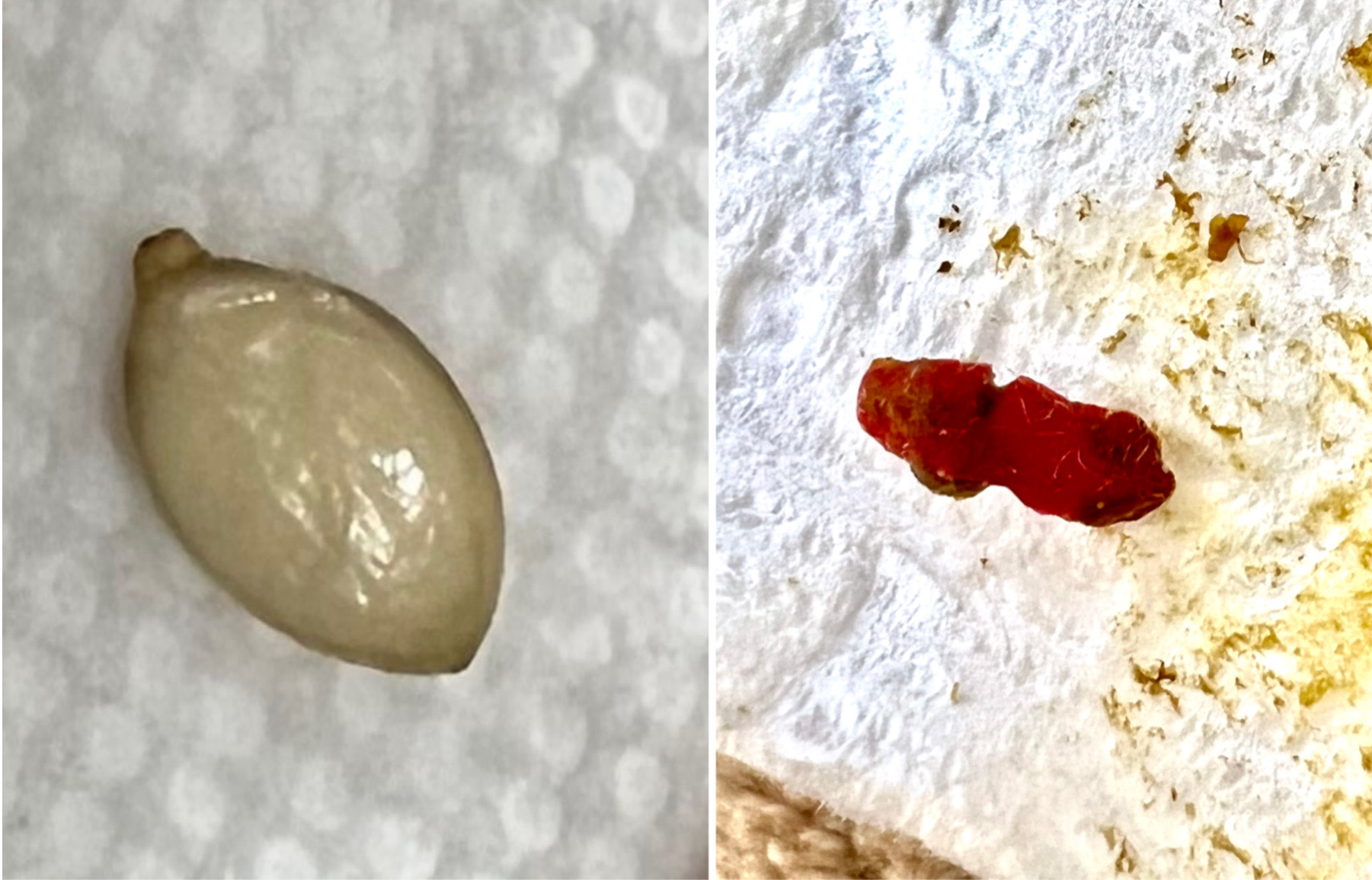 What Do Intestinal Parasites Look Like In Stool - Infoupdate.org