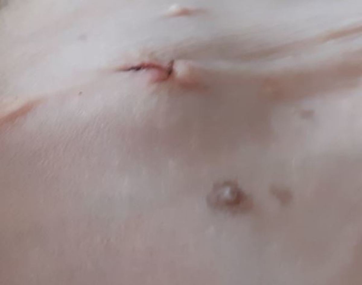 How to Tell if Your Female Dog Has Been Spayed or Fixed - PetHelpful