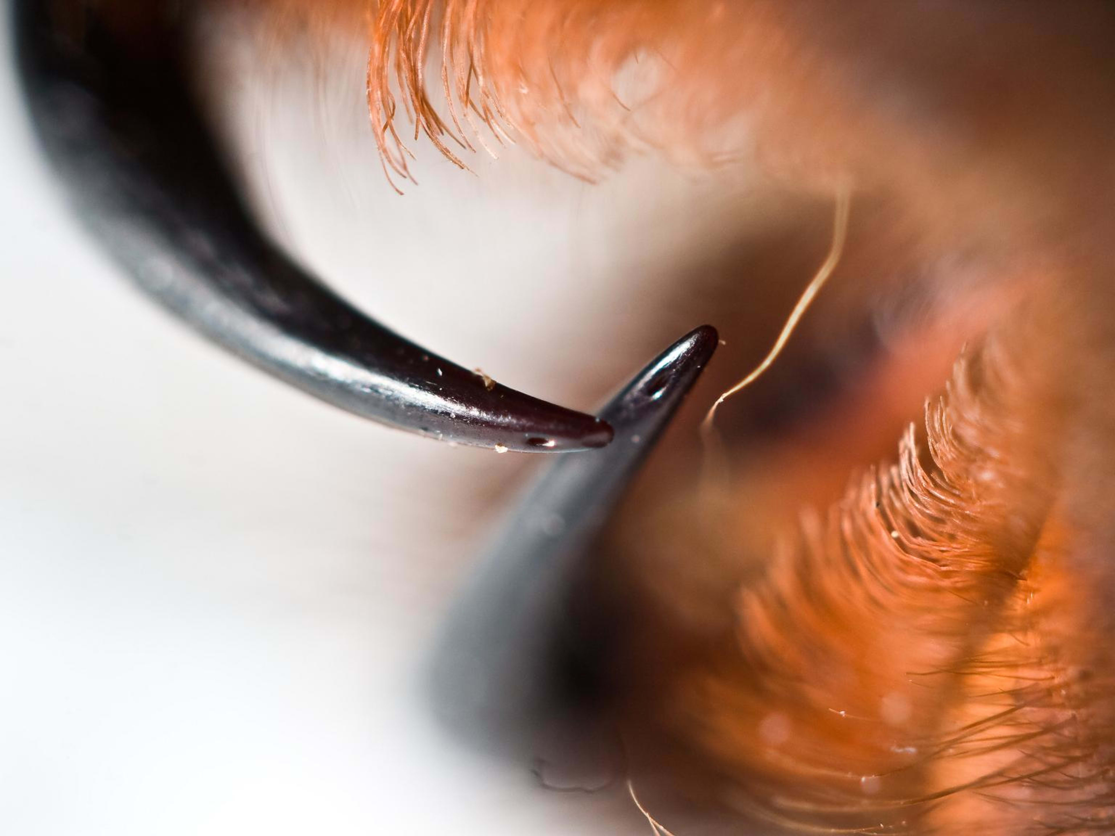 Are Tarantula Bites Dangerous?