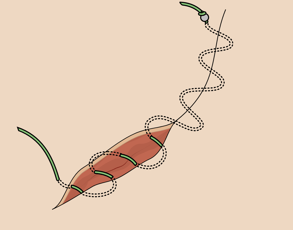 How to Care for Dog Stitches After Surgery (Vet-Reviewed) - PetHelpful