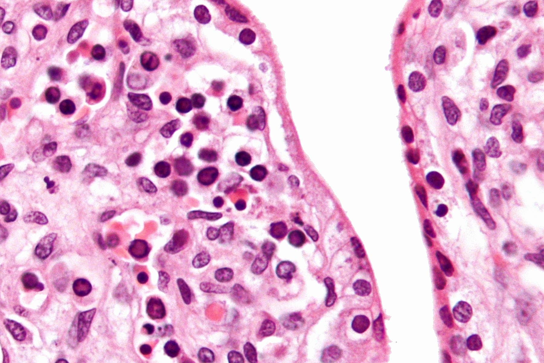 Canine Parvovirus: Symptoms, Treatment and Prevention - PetHelpful